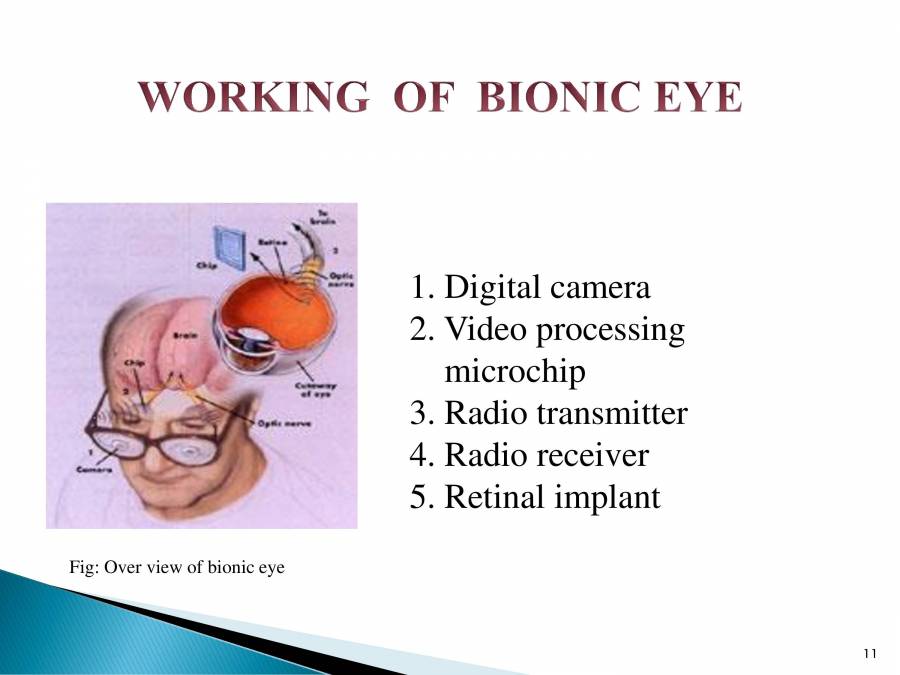 Bionic Eye - PowerPoint Slides - LearnPick India