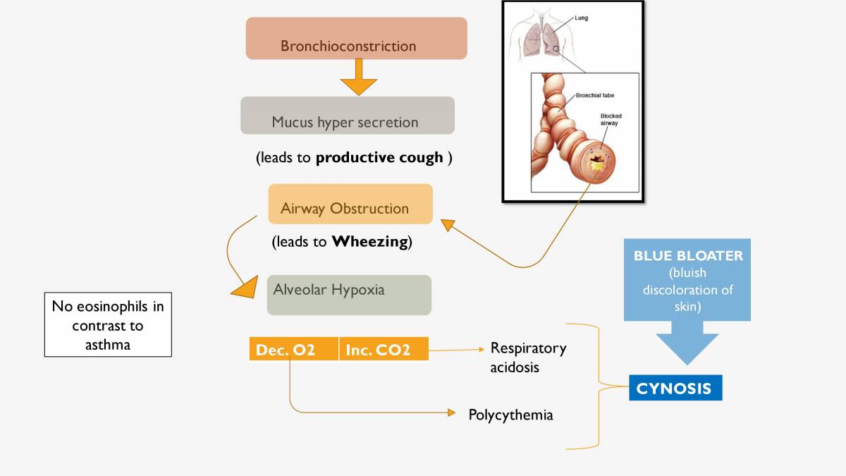 Presentation On Bronchitis - PowerPoint Slides - LearnPick India