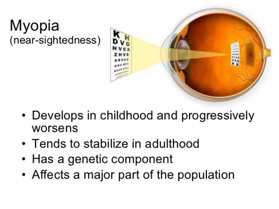 Presentation On Human Eye - PowerPoint Slides - LearnPick India