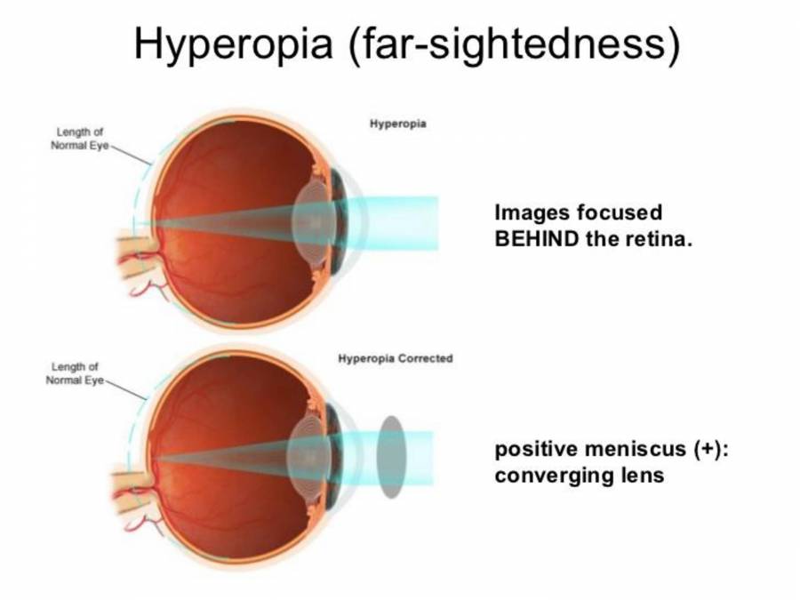 Presentation On Human Eye - PowerPoint Slides - LearnPick India