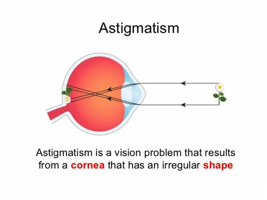 Presentation On Human Eye - PowerPoint Slides - LearnPick India