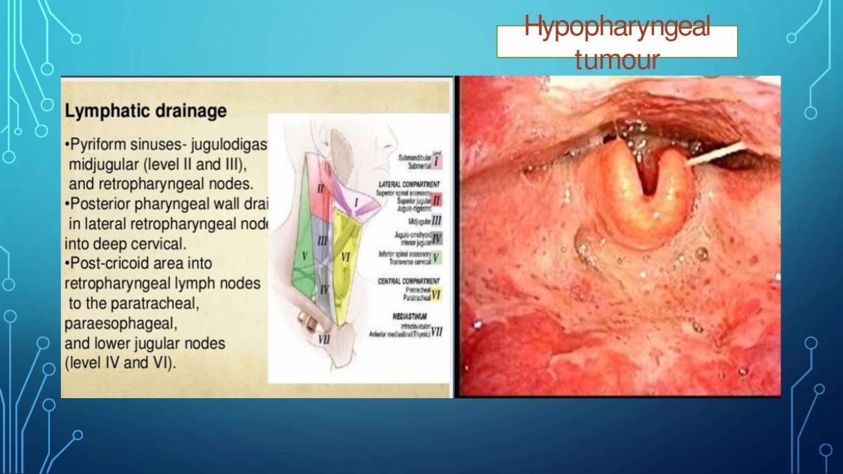 Presentation On Anatomy Of Hypopharynx - PowerPoint Slides - LearnPick ...