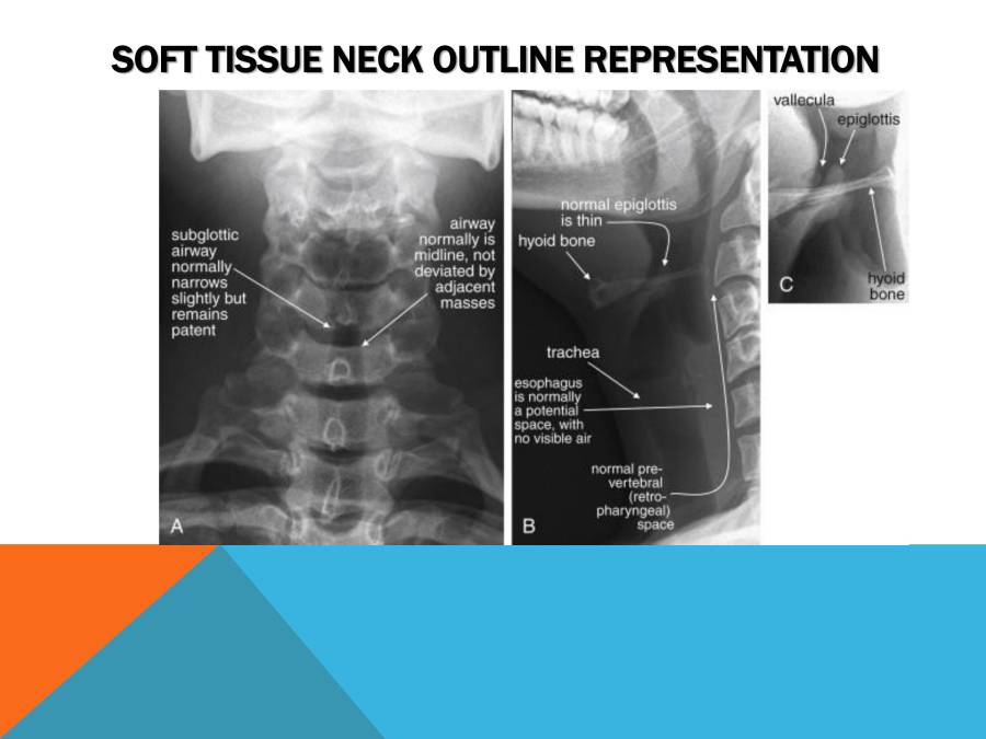 Soft Tissue Neck Radiography (Routine & Special) - PowerPoint Slides ...