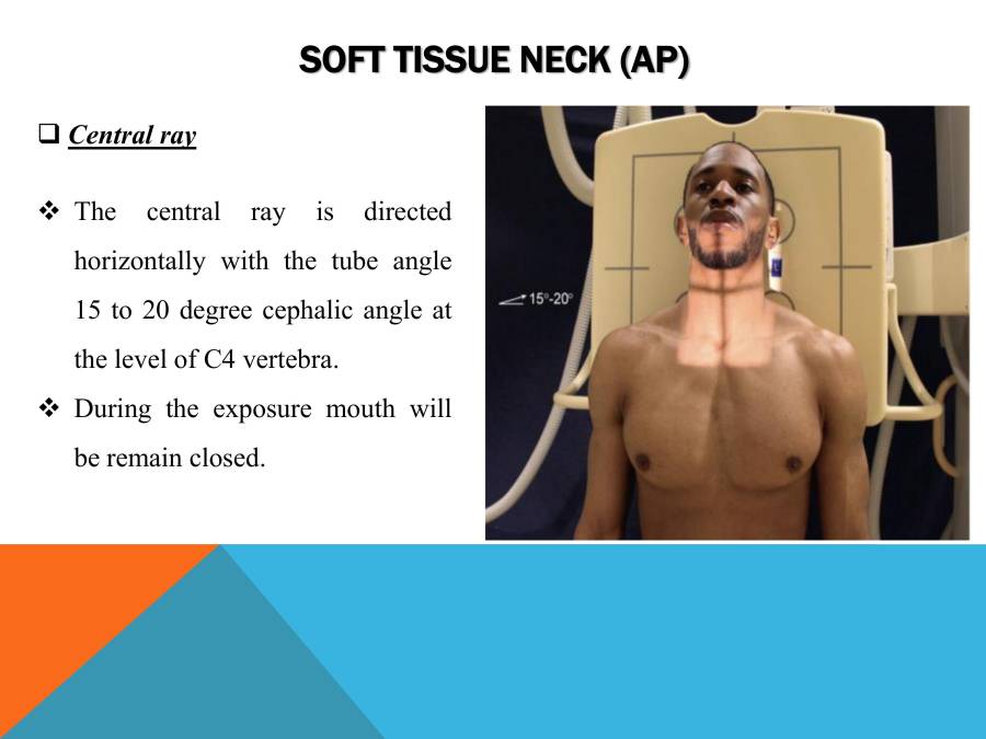 Soft Tissue Neck Radiography (Routine & Special) - PowerPoint Slides ...