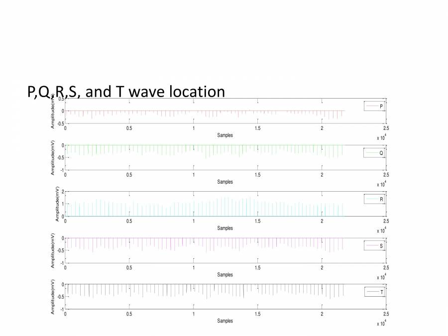 Optimal ECG Data Compression For An E-Health Transmission System - PowerPoint Slides - LearnPick ...