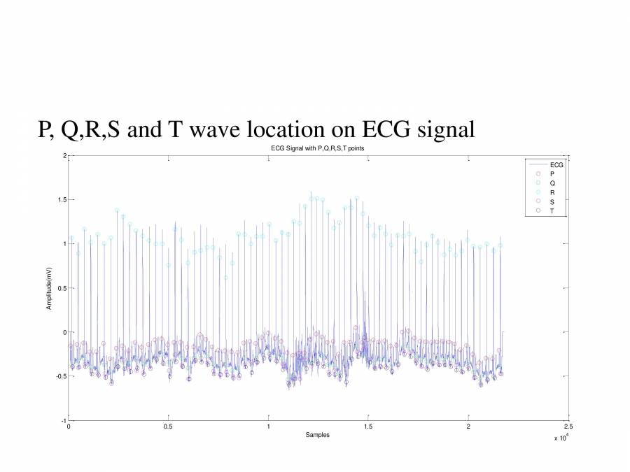 Optimal ECG Data Compression For An E-Health Transmission System - PowerPoint Slides - LearnPick ...