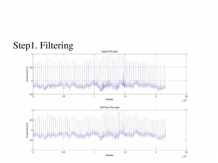 Optimal ECG Data Compression For An E-Health Transmission System - PowerPoint Slides - LearnPick ...