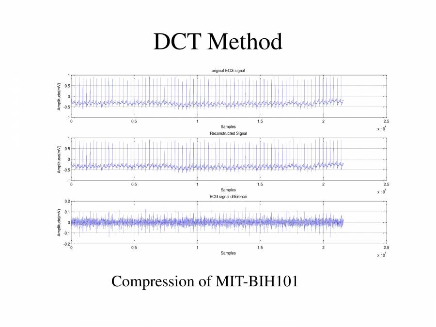 Optimal ECG Data Compression For An E-Health Transmission System - PowerPoint Slides - LearnPick ...