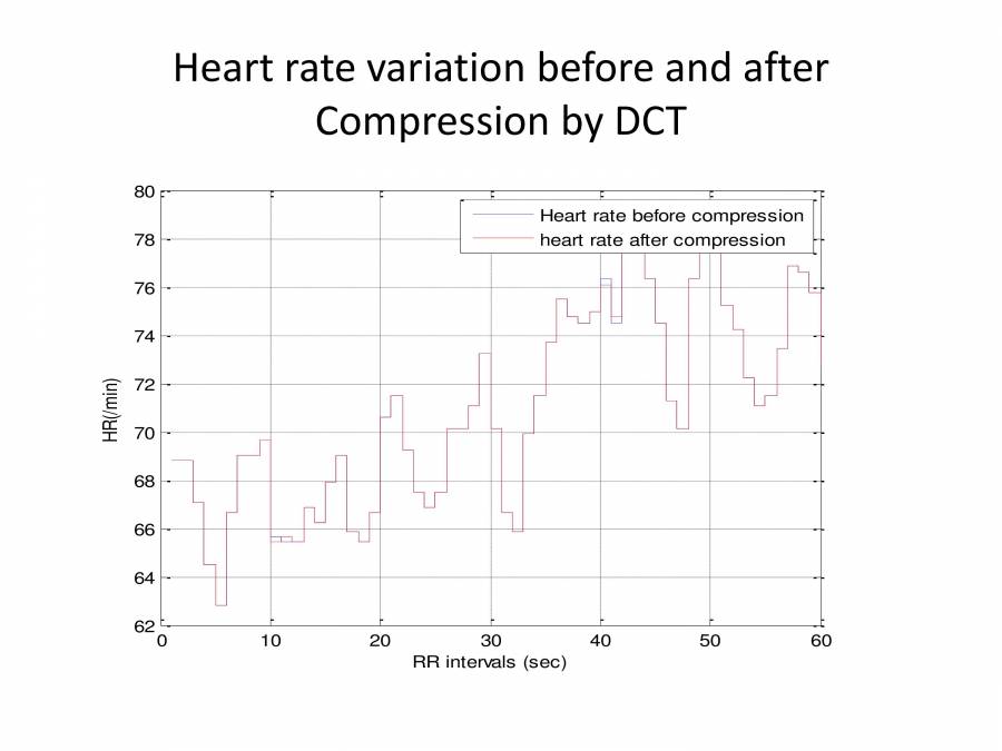 Optimal ECG Data Compression For An E-Health Transmission System - PowerPoint Slides - LearnPick ...