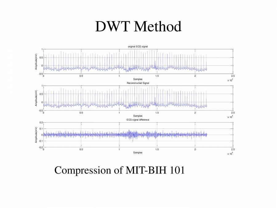 Optimal ECG Data Compression For An E-Health Transmission System - PowerPoint Slides - LearnPick ...