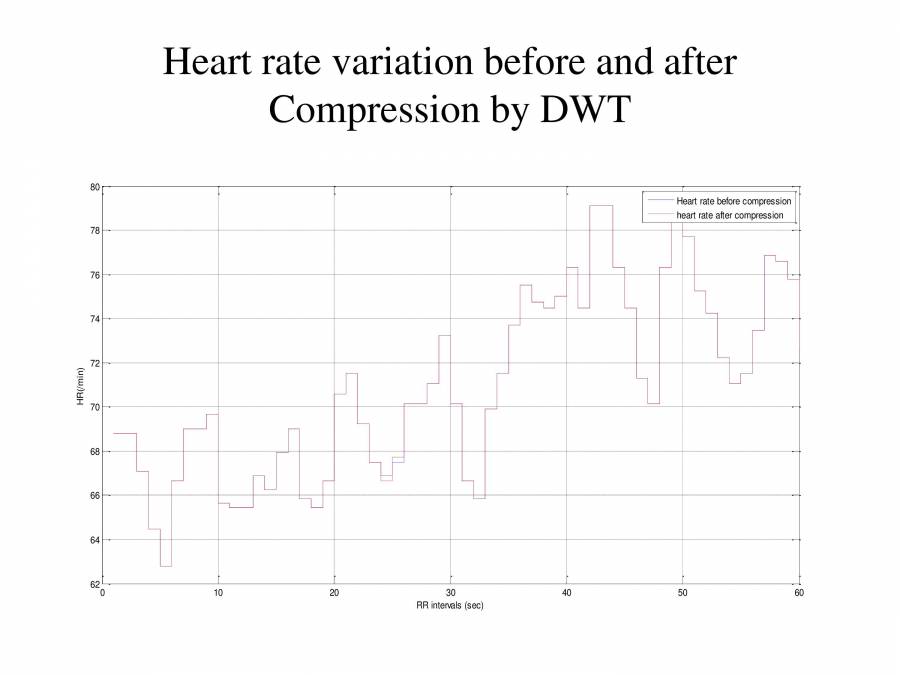 Optimal ECG Data Compression For An E-Health Transmission System - PowerPoint Slides - LearnPick ...
