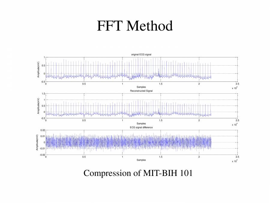 Optimal ECG Data Compression For An E-Health Transmission System - PowerPoint Slides - LearnPick ...