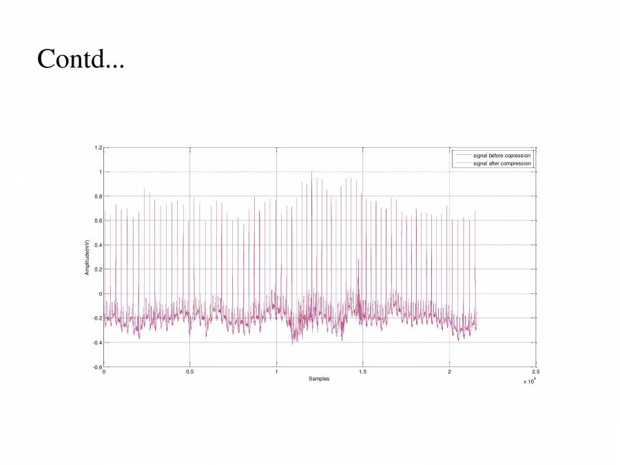 Optimal ECG Data Compression For An E-Health Transmission System - PowerPoint Slides - LearnPick ...