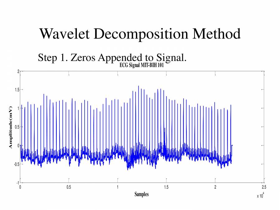 Optimal ECG Data Compression For An E-Health Transmission System - PowerPoint Slides - LearnPick ...