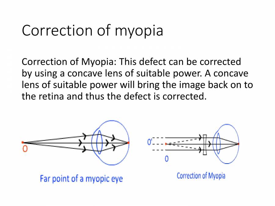 Human Eye - PowerPoint Slides - LearnPick India