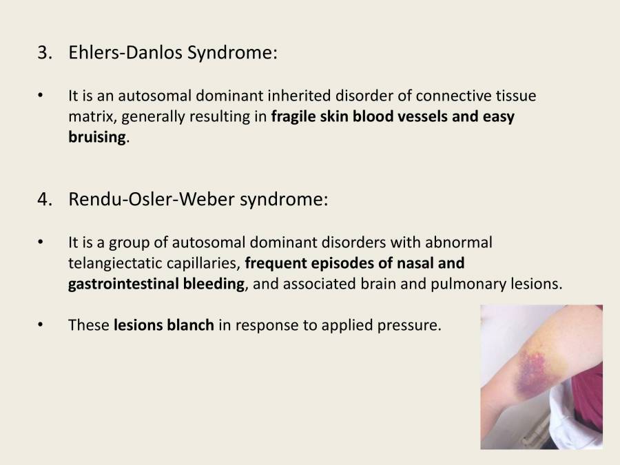 Bleeding And Clotting Disorders - PowerPoint Slides - LearnPick India
