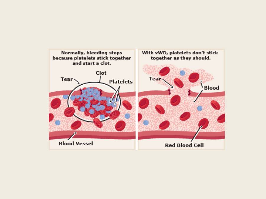 Bleeding And Clotting Disorders - PowerPoint Slides - LearnPick India